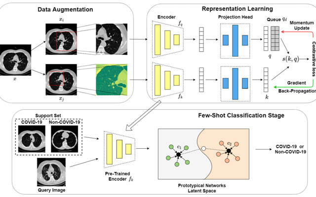 Momentum Contrastive Learning for Few-Shot COVID-19 Diagnosis from ...